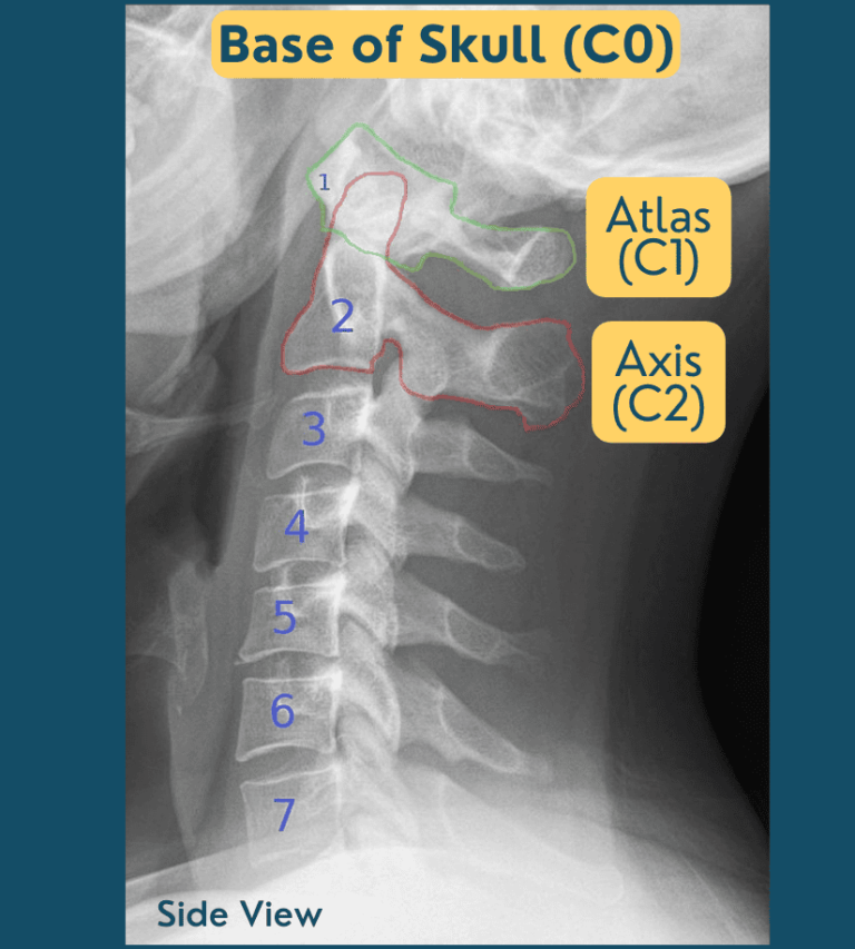 Understanding Neck Hypermobility | Jeannie Di Bon